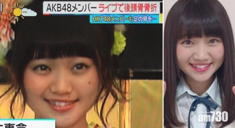 【AKB成員意外】稻垣香織墮台頭骨骨折 | am730